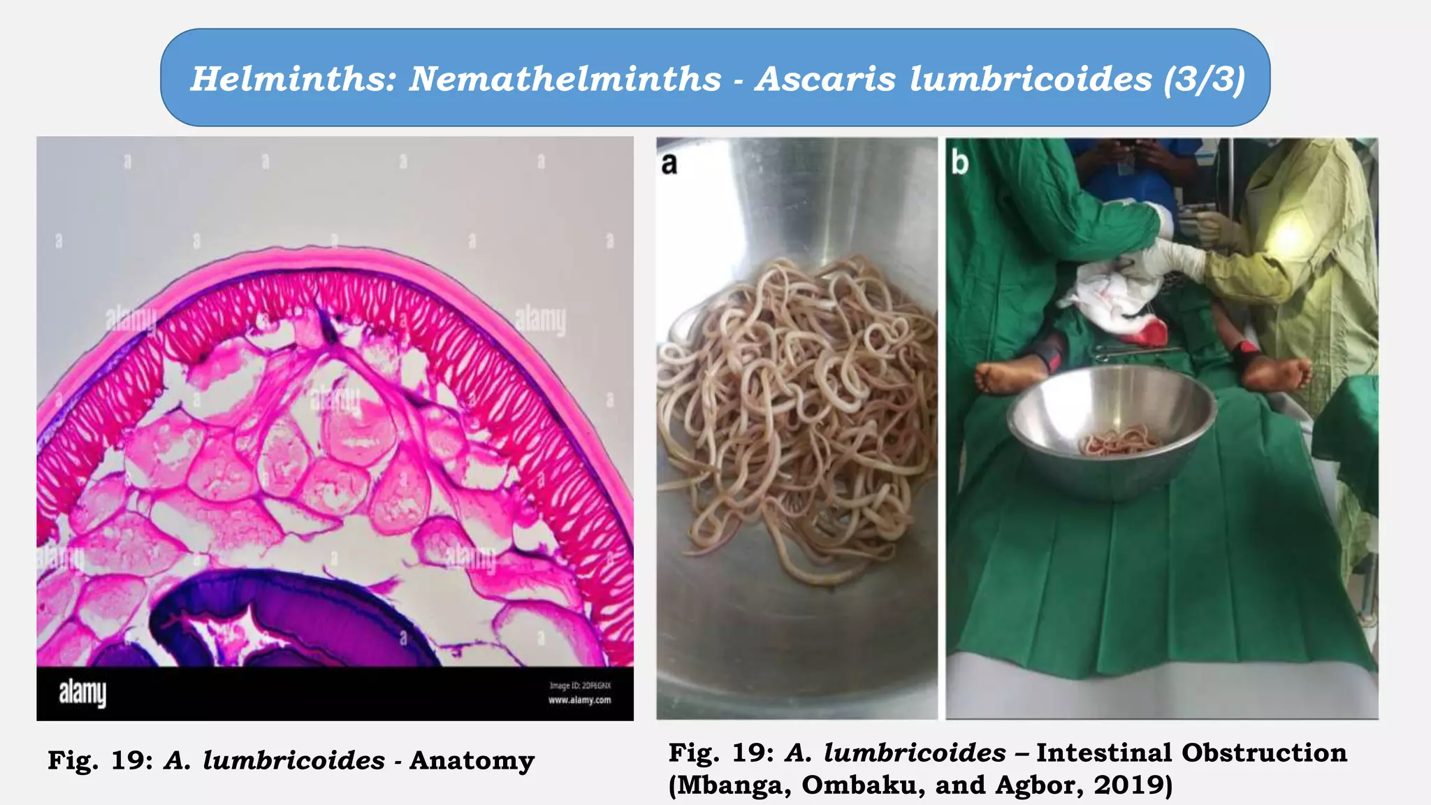 Intestinal parasites | PPTX
