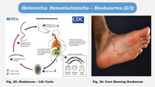 Intestinal parasites | PPTX