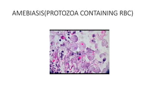 Intestinal Pathologies - Obstruction and Diarrhea by Dr. Zahid Mahmood ...