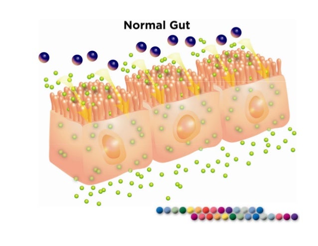 LEAKY GUT Intestinal permeability