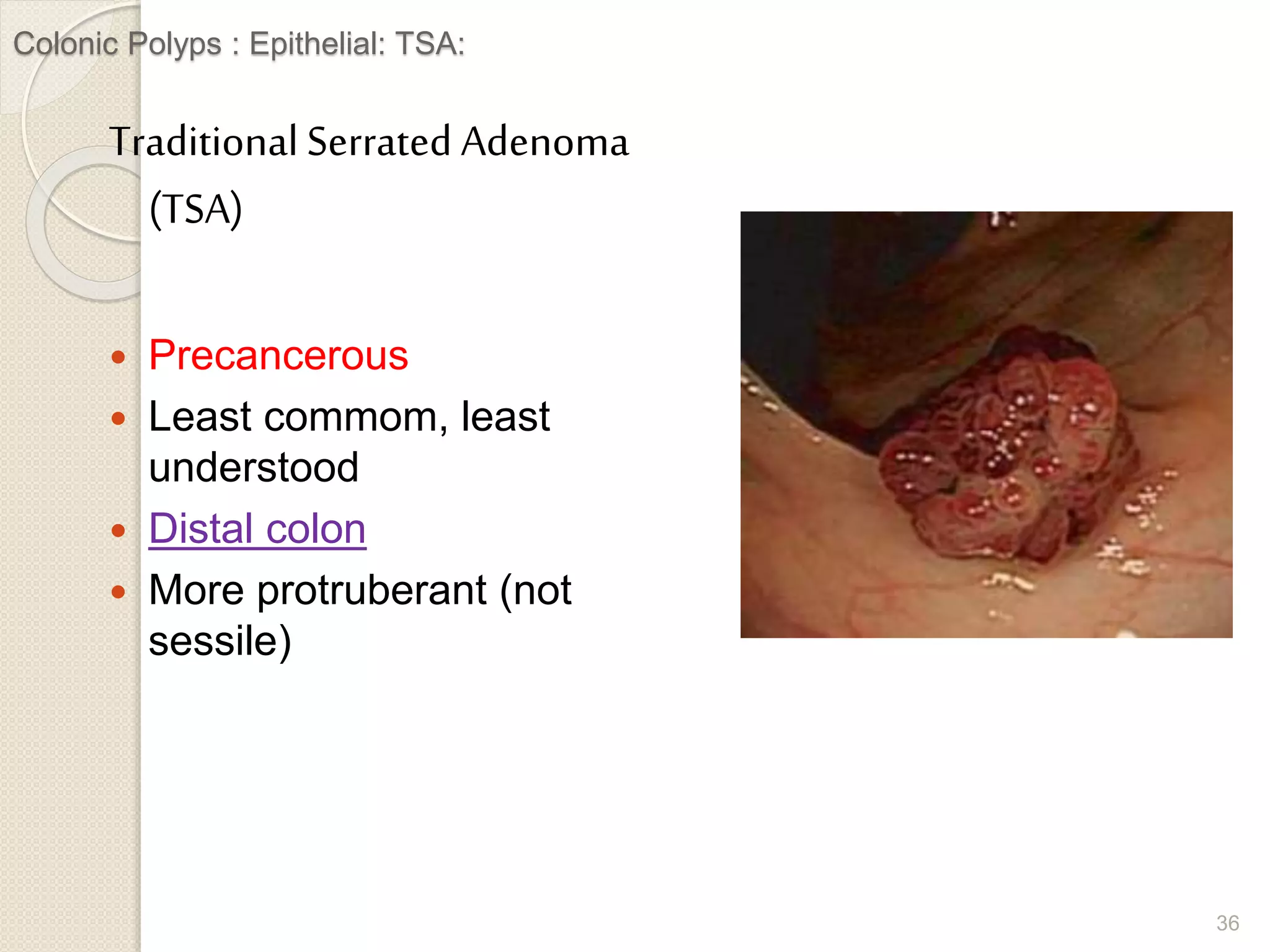 Intestinal polyps | PPTX