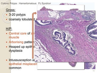 Intestinal polyps | PPTX