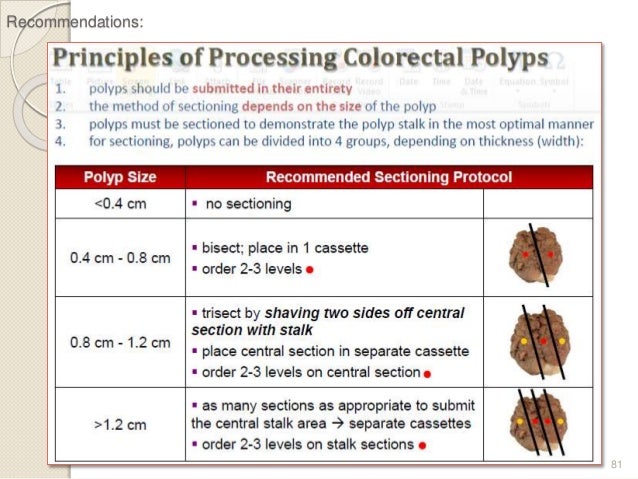 Grading Colon Polyps