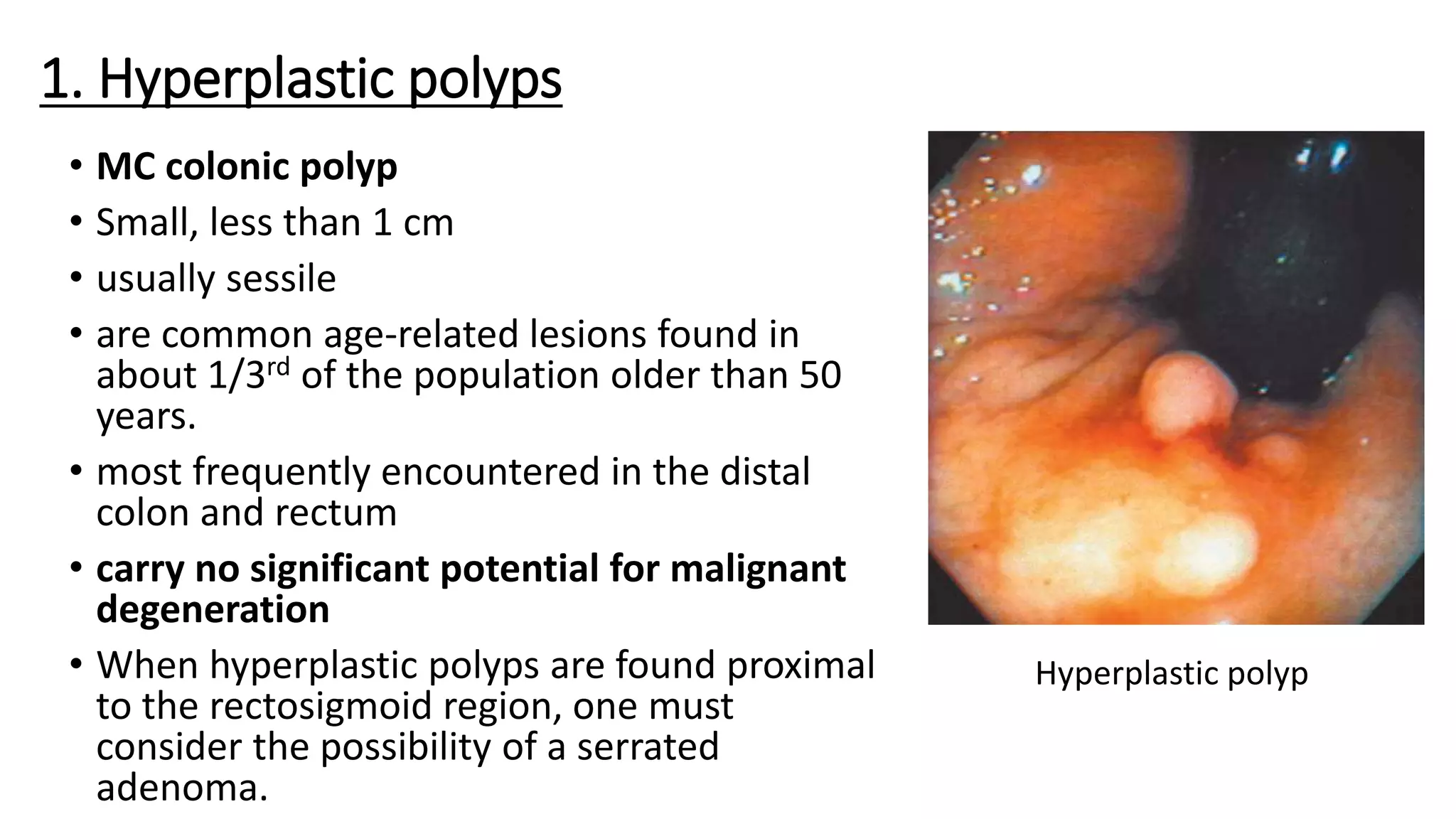 Intestinal polyps | PPTX