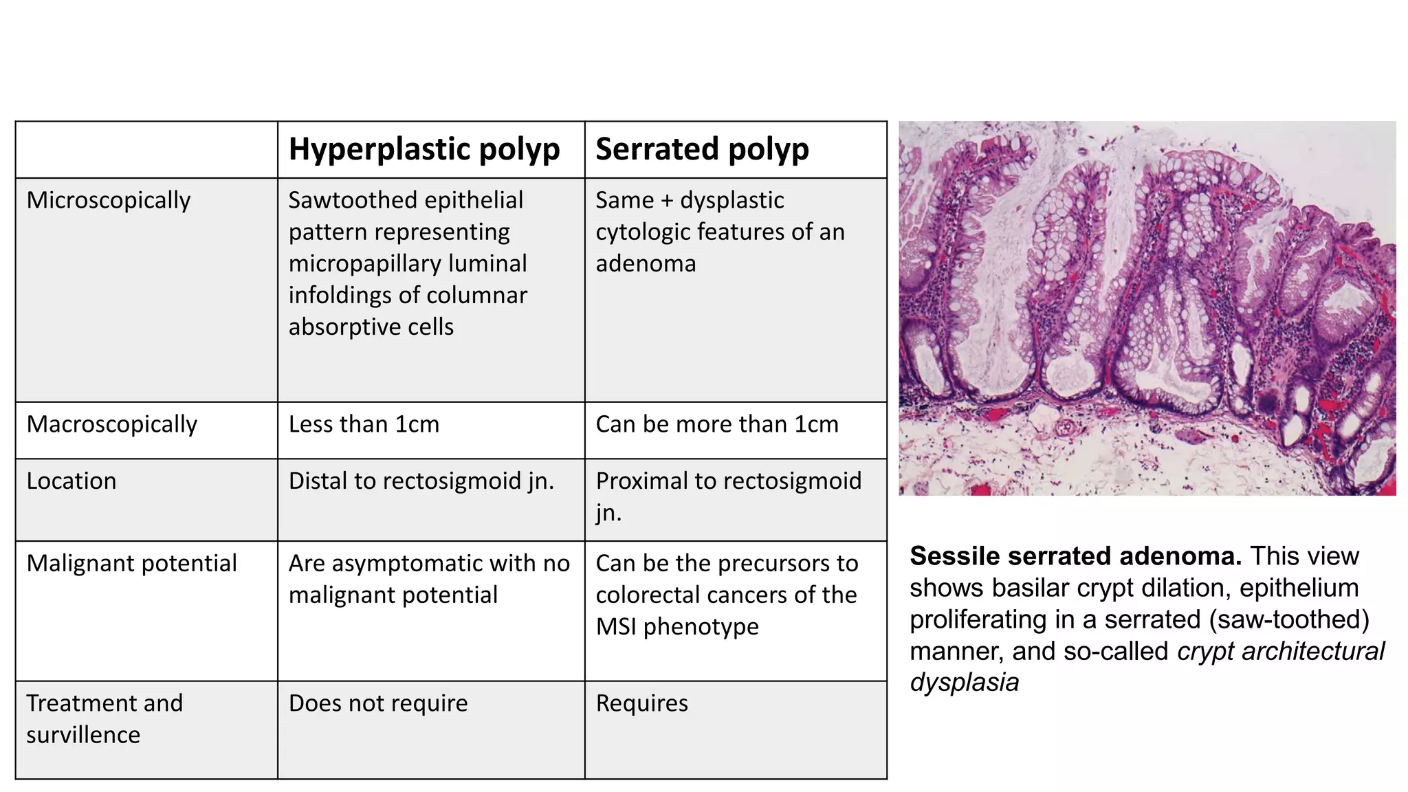 Intestinal polyps | PPTX