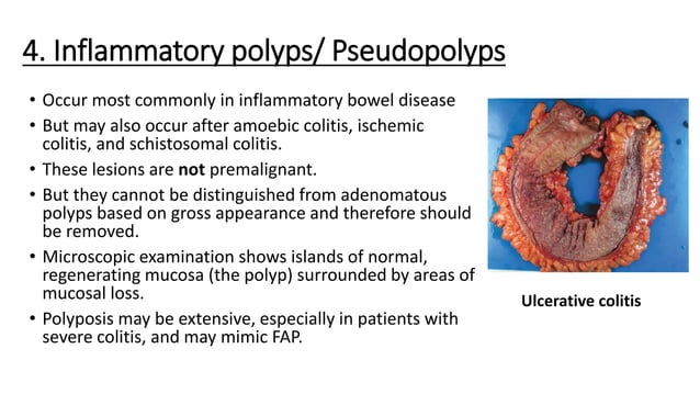 Intestinal polyps | PPTX | Digestive Disorders | Diseases and Conditions