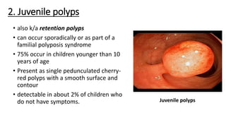 Juvenile Polyp
