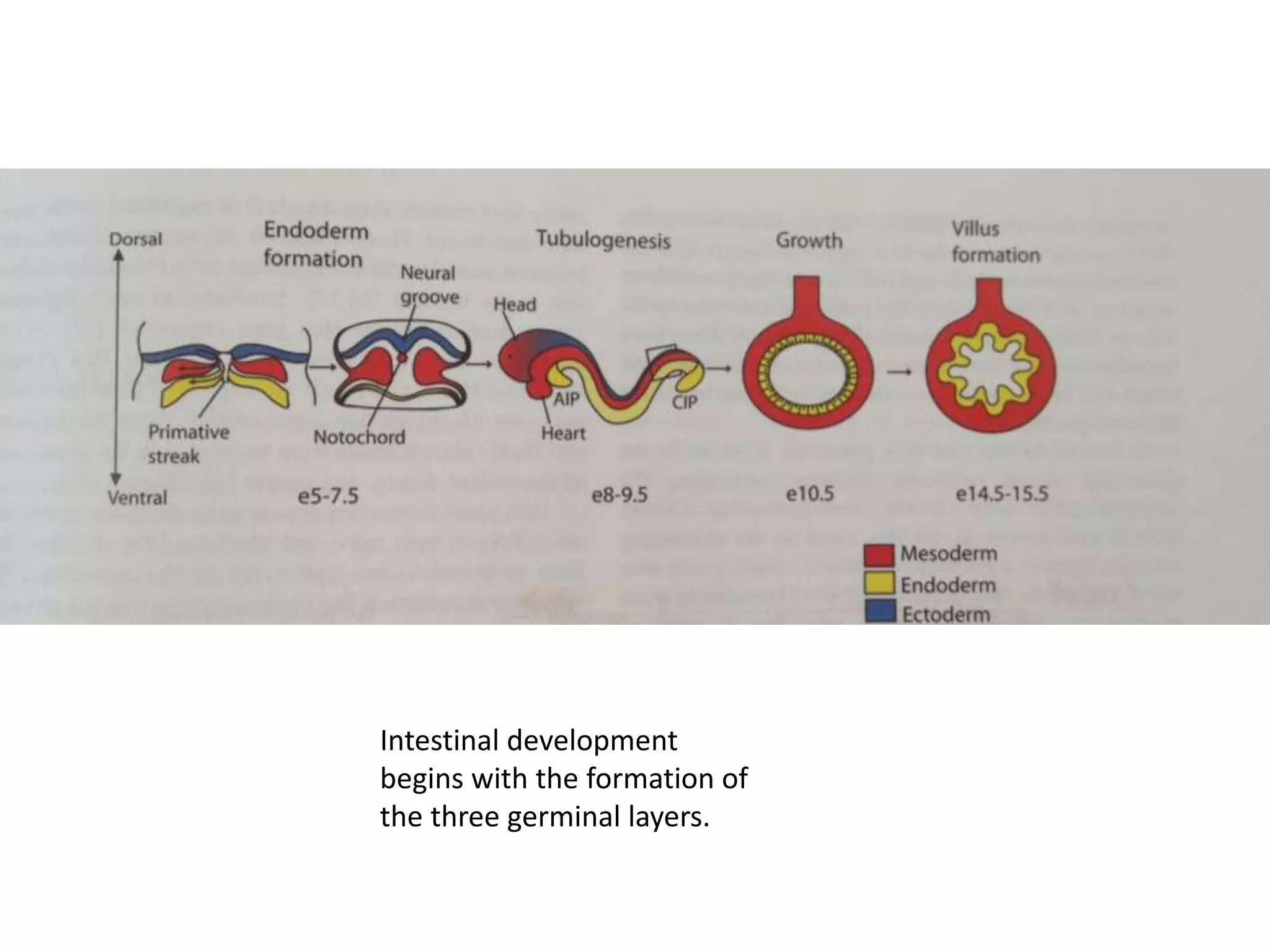 Intestinal regeneration biology approach | PPTX