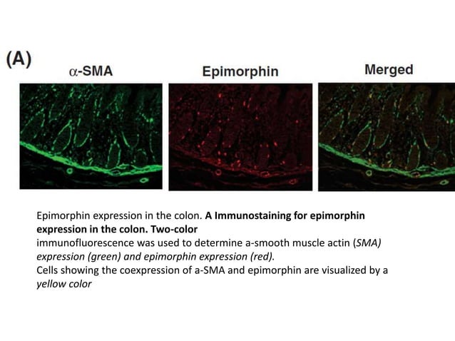 Intestinal regeneration biology approach | PPTX