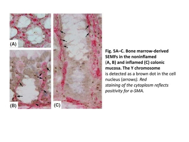 Intestinal regeneration biology approach | PPTX