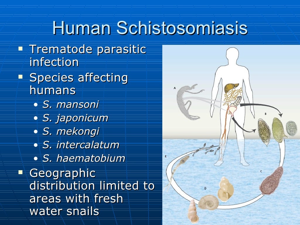 Intestinal Schistosomiasis
