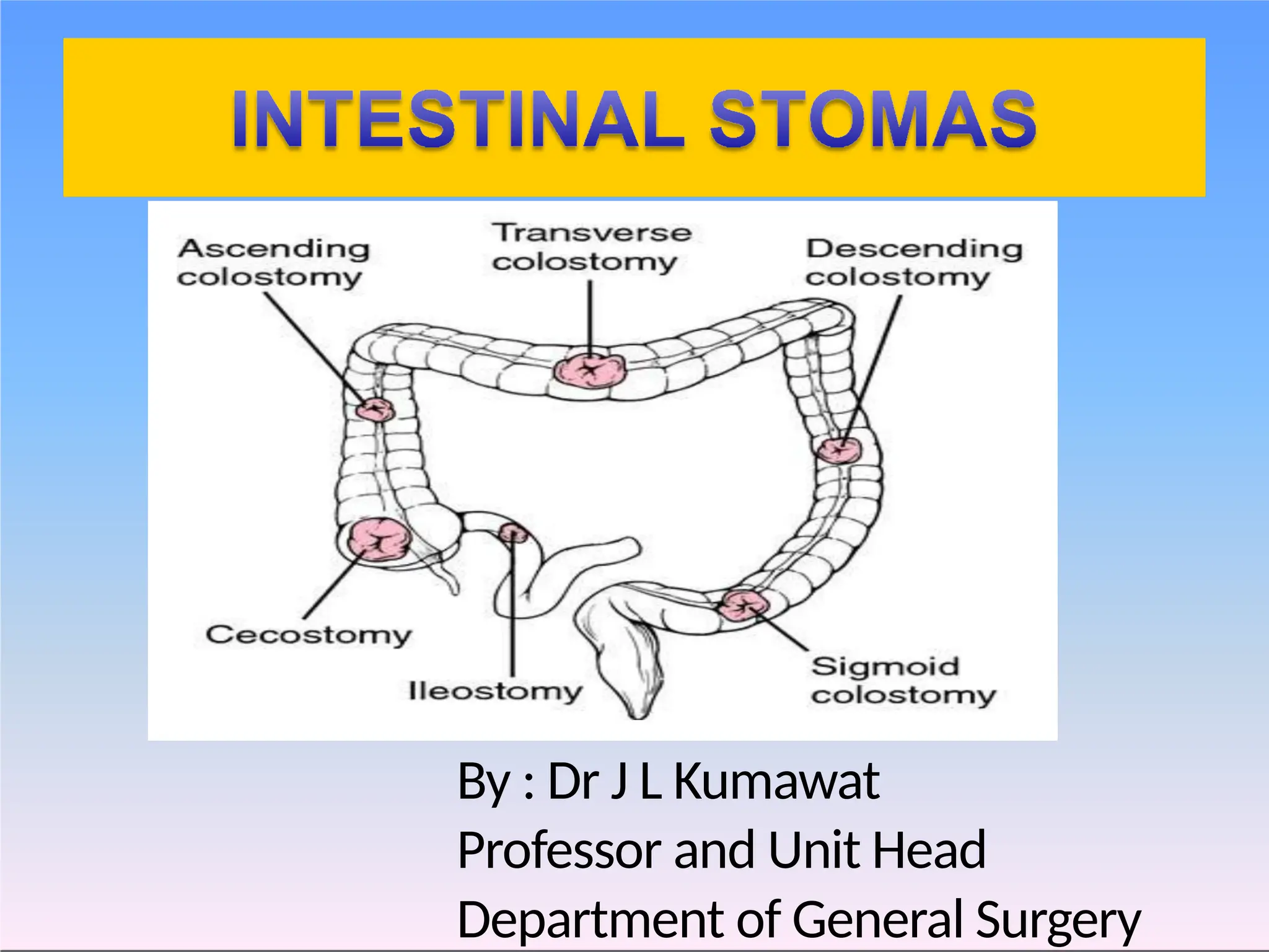 Intestinal Stomas general surgery srb.pptx