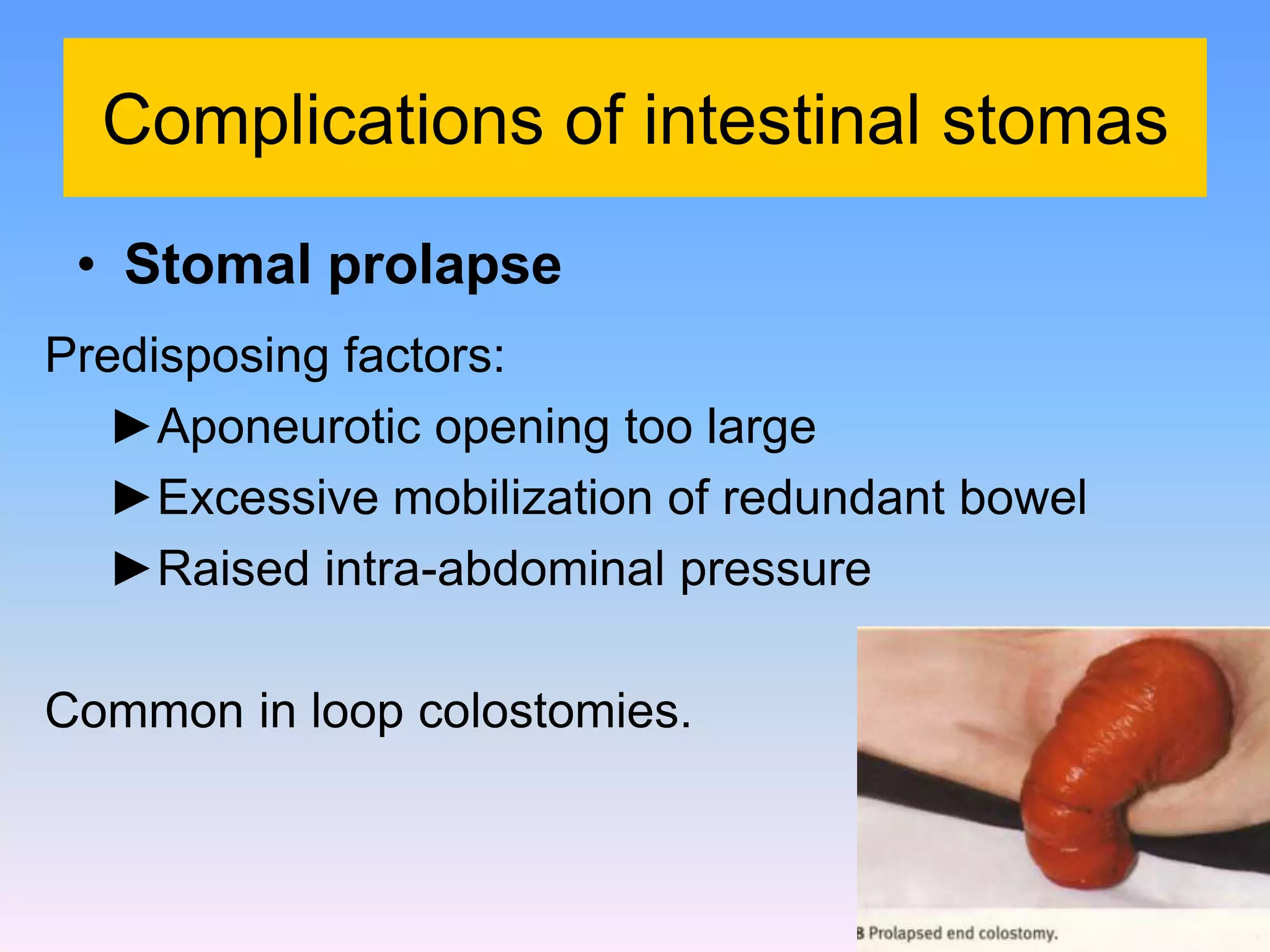 Intestinal stomas | PDF