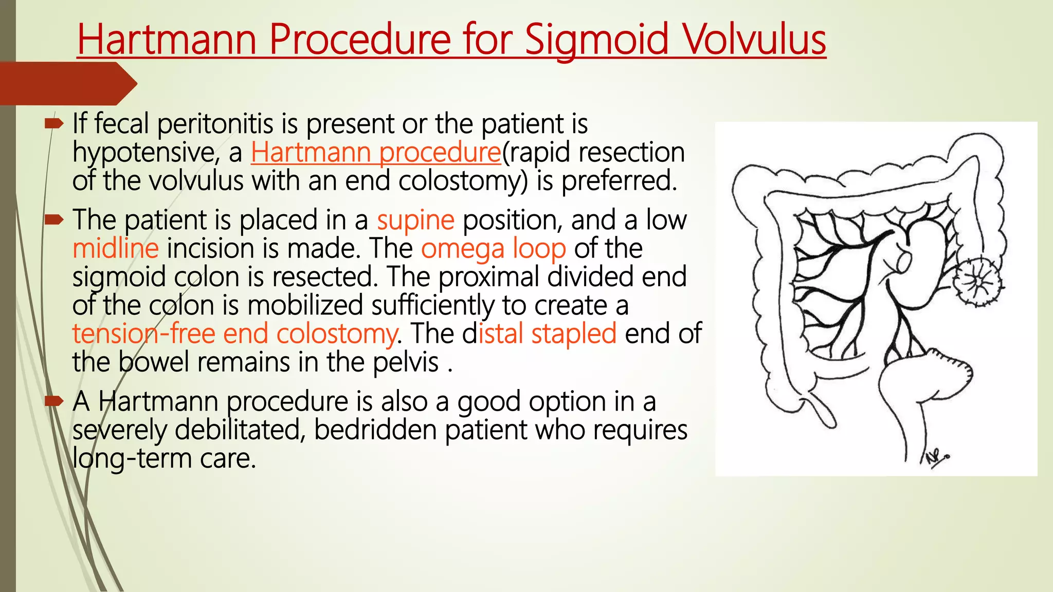 Intestinal ( Bowel) strangulation