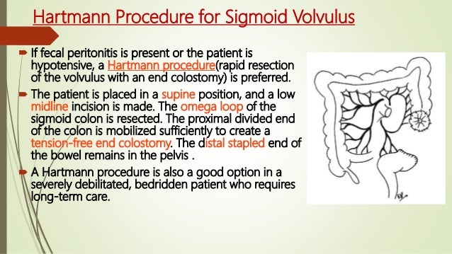 Intestinal ( Bowel) strangulation