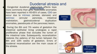 New born intestinal obstraction surgery.pptx