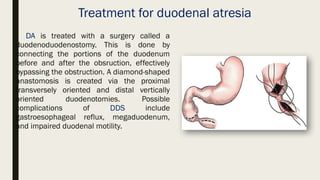 New born intestinal obstraction surgery.pptx