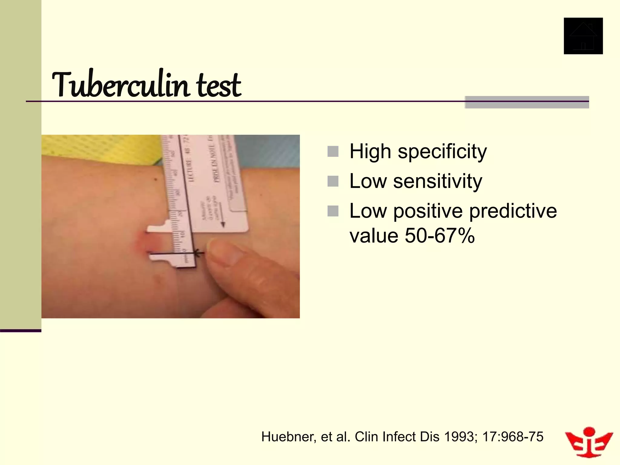 Intestinal tuberculosis | PPT