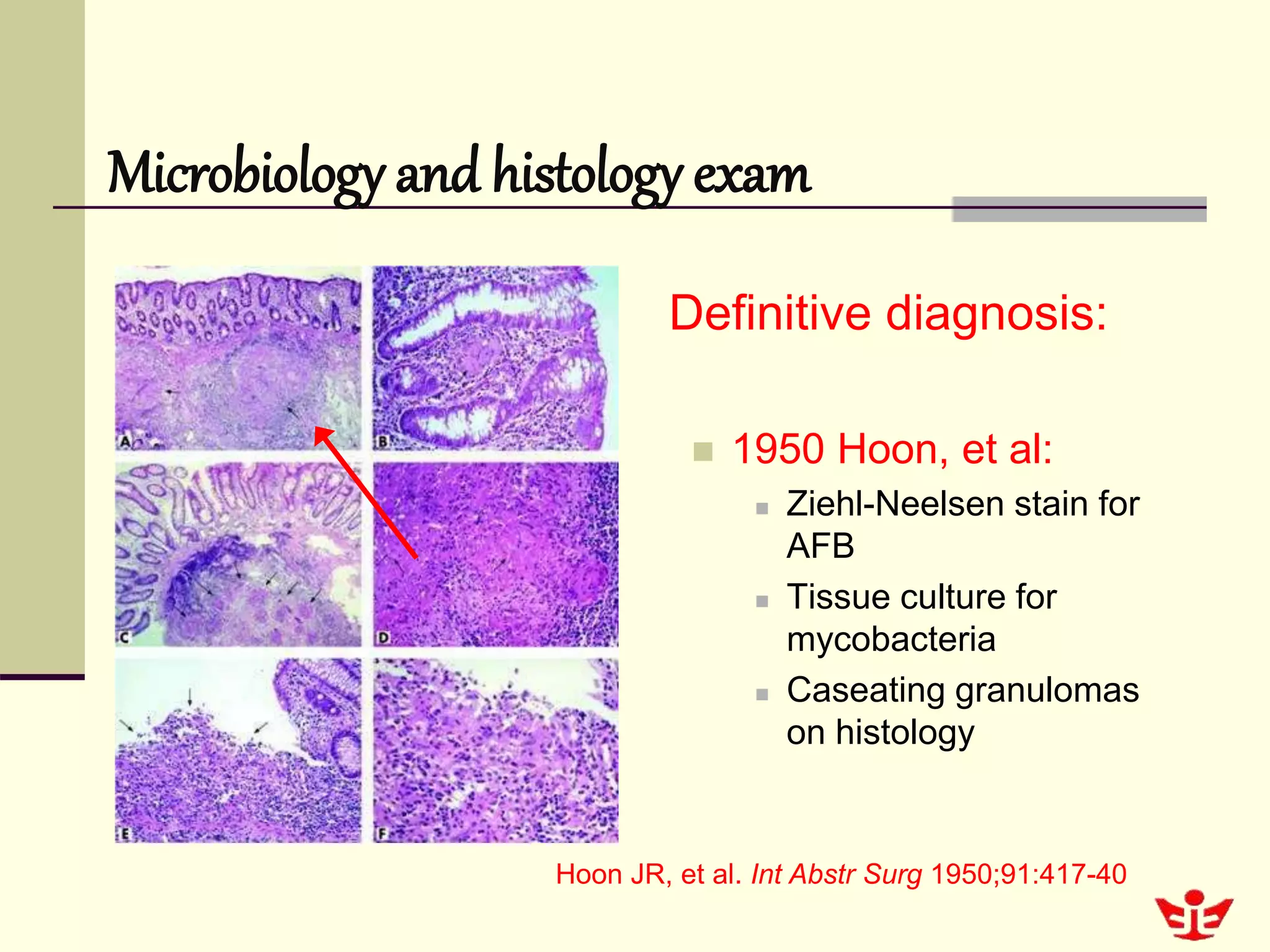 Intestinal tuberculosis | PPT