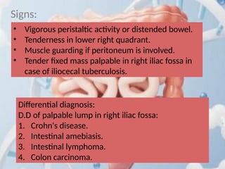presentation for Intestinal tuberculosis.pptx