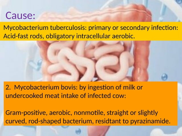 presentation for Intestinal tuberculosis.pptx | Digestive Disorders ...