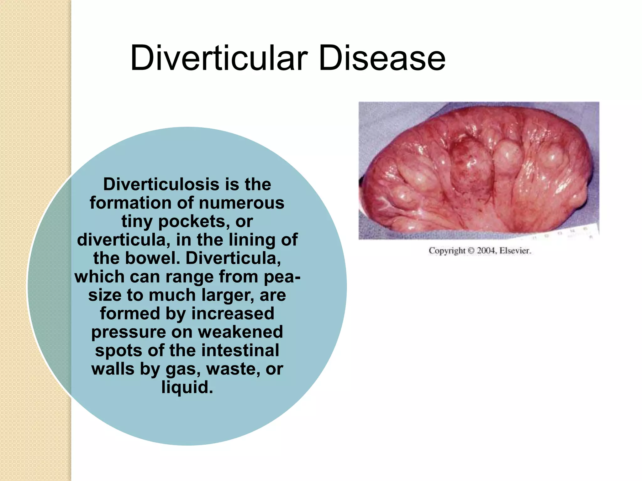 APPLIED AND BASIC INTRO OF SMALL INTESTINE | PPTX