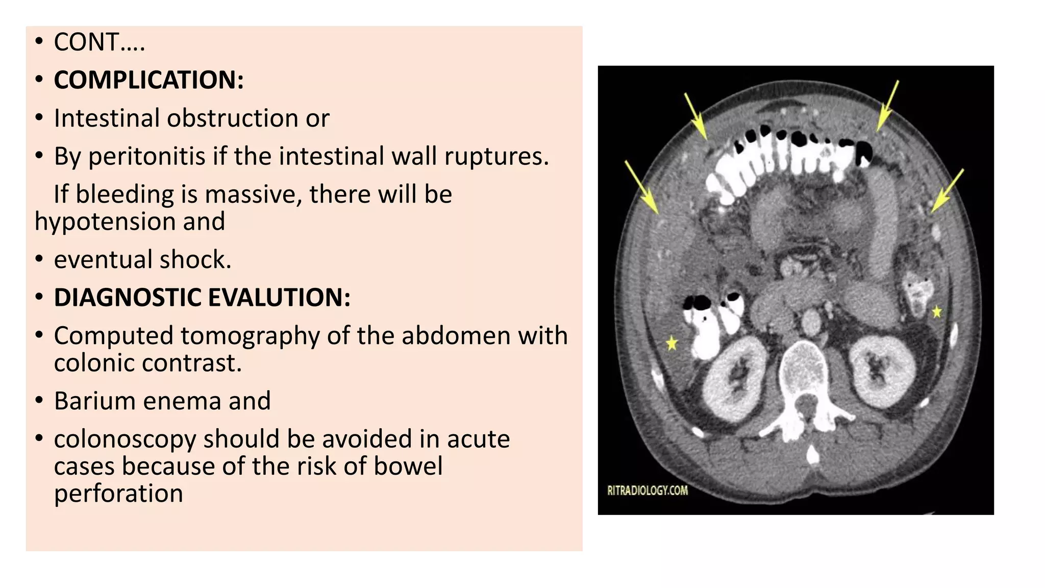 DISORDER OR LARGE INTESTINE | PPTX