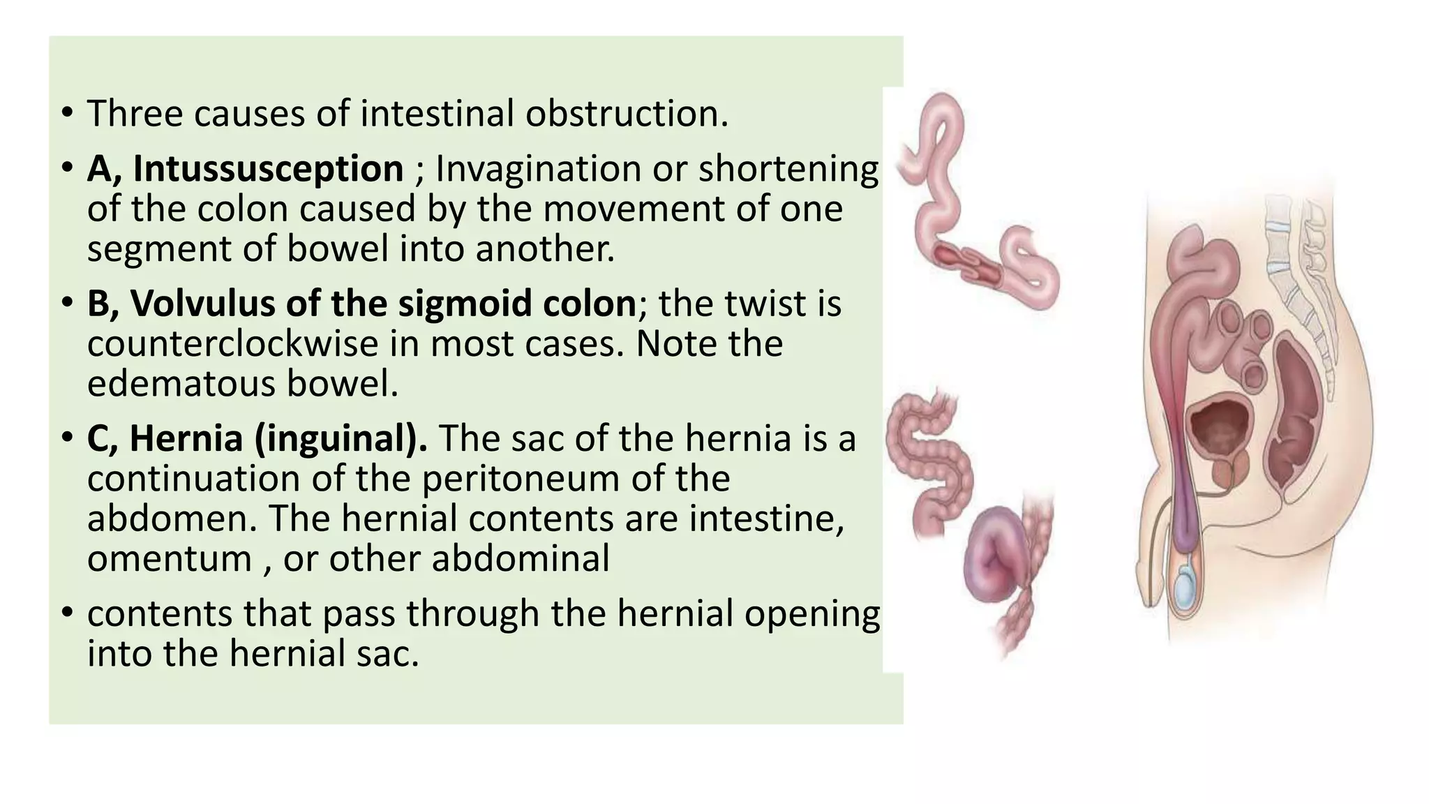 DISORDER OR LARGE INTESTINE | PPTX