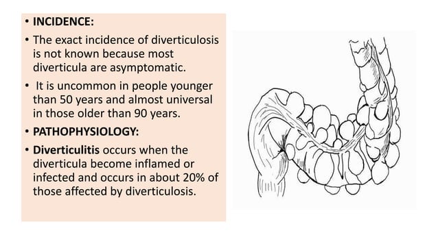 DISORDER OR LARGE INTESTINE | PPT