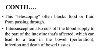 INTESTINE OBSTRUCTION.pptx