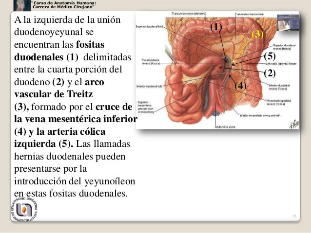 Ligamento De Treitz