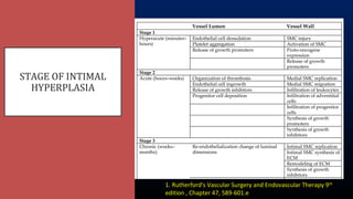Intimal hyperplasia | PPT