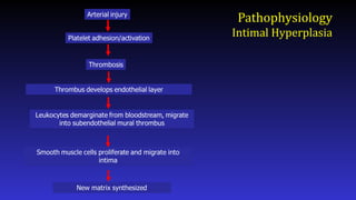 Intimal hyperplasia | PPT