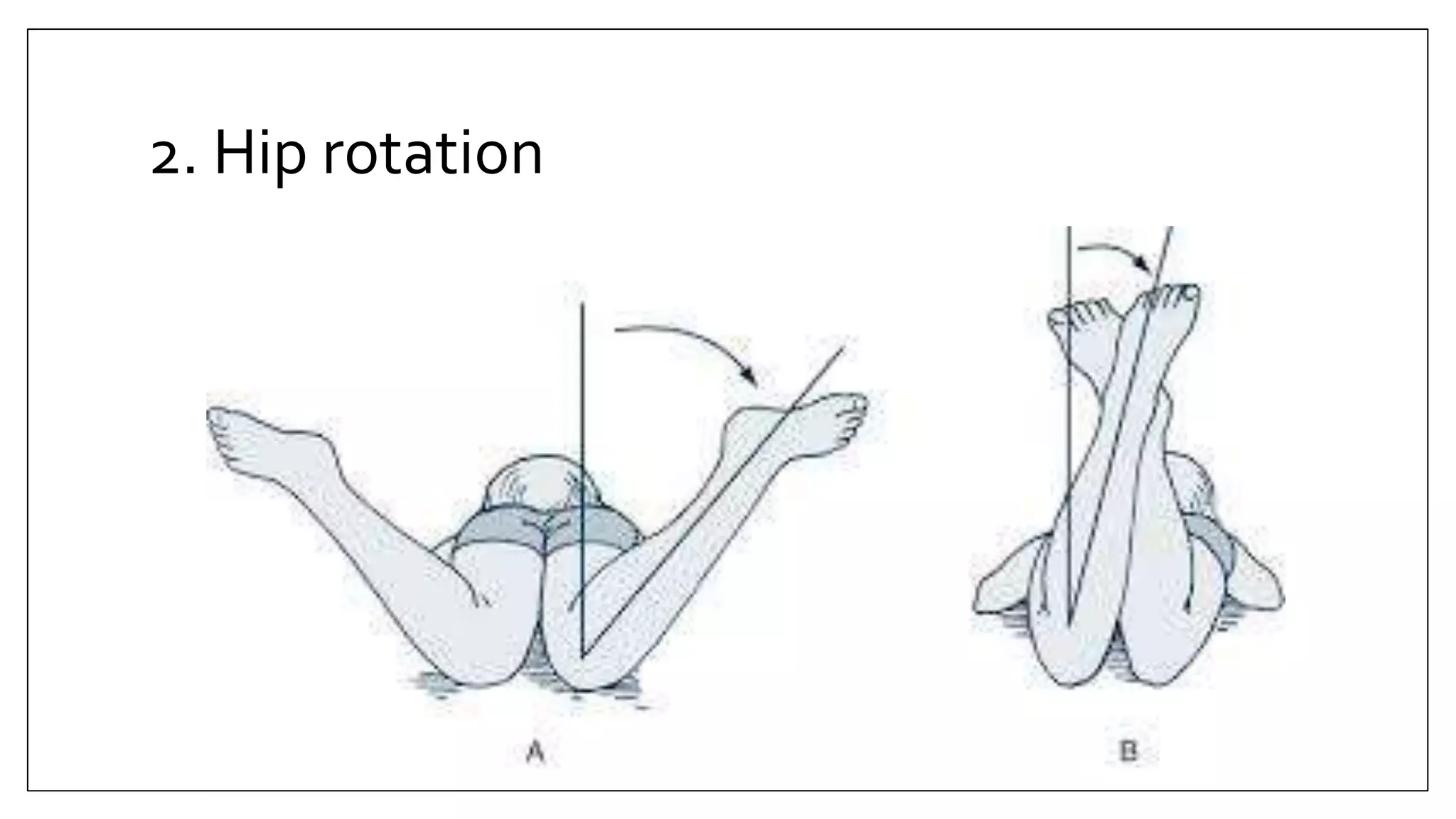 Intoeing gait | PPTX