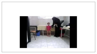 Intoeing gait | PPTX