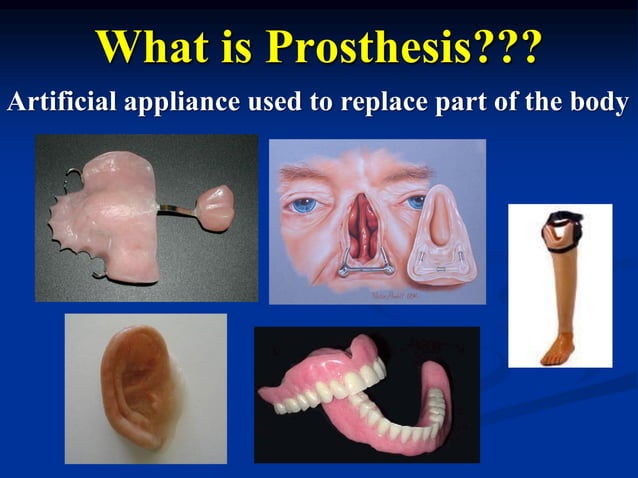 Introduction to Removable Prosthesis | PDF