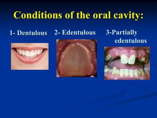 Introduction to Removable Prosthesis | PDF