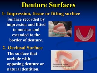 Introduction to Removable Prosthesis | PDF