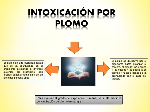 Intoxicación por plomo