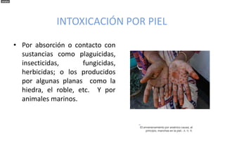 INTOXICACIÓN | PDF