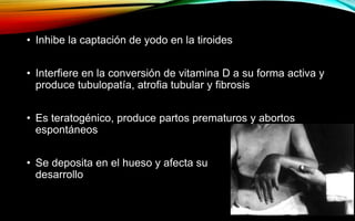 Intoxicacion por plomo | PPTX