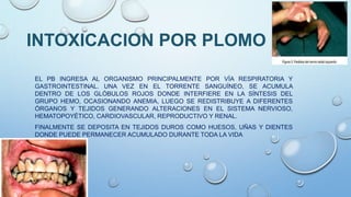 INTOXICACION POR PLOMO.pptx