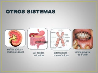 INTOXICACION POR PLOMO O SATURNISMO pptx | PPTX