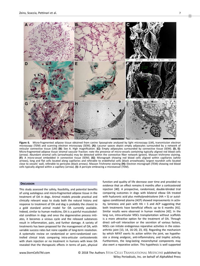 Intra-Articular Administration of Autologous Micro-Fragmented Adipose ...