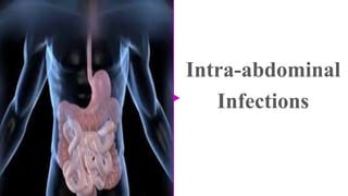 Clinical Cases Study for Intra-abdominal infections | PPTX