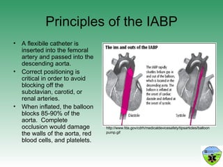 Intra Aortic Balloon Pump Animation