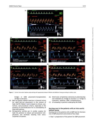 Intra aortic balloon pump | PDF