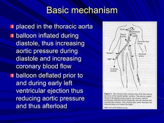 Intra-aortic Balloon 00 and the Pump.ppt