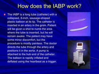 Intra-aortic Balloon 00 and the Pump.ppt