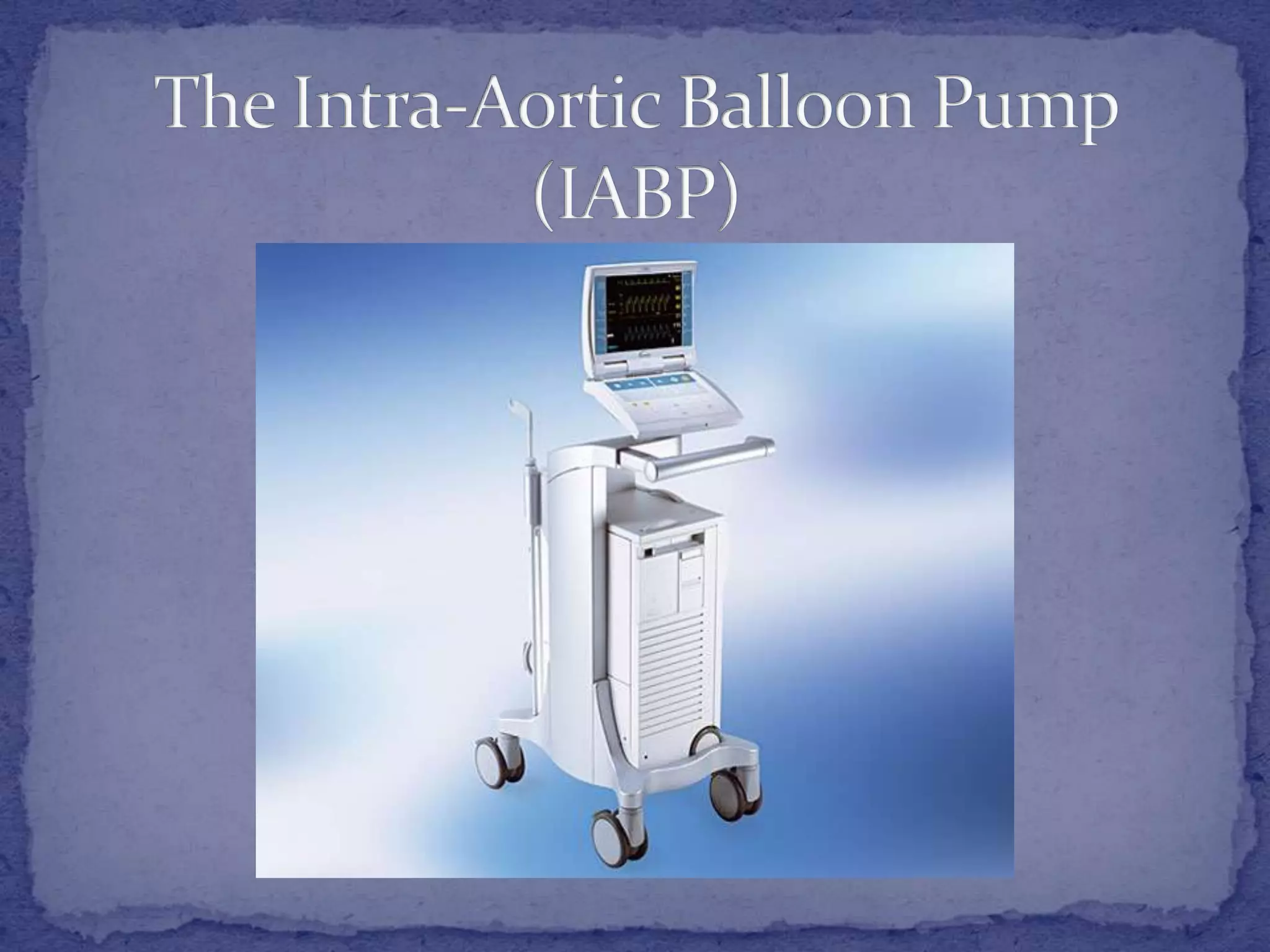 Intra aortic balloon pumps | PPTX